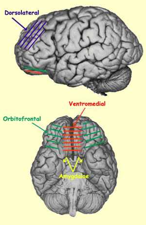 ventromedial cortex